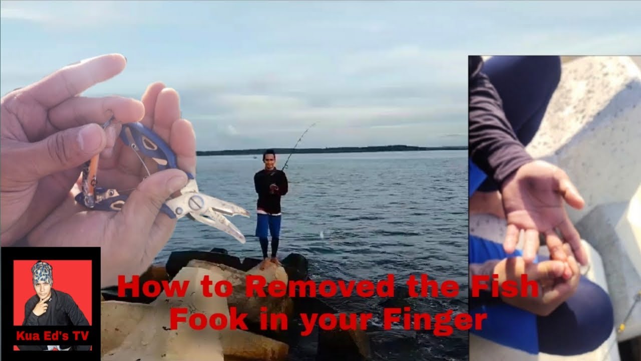 How to Removed Fish Hook 🪝 in your Finger. - YouTube