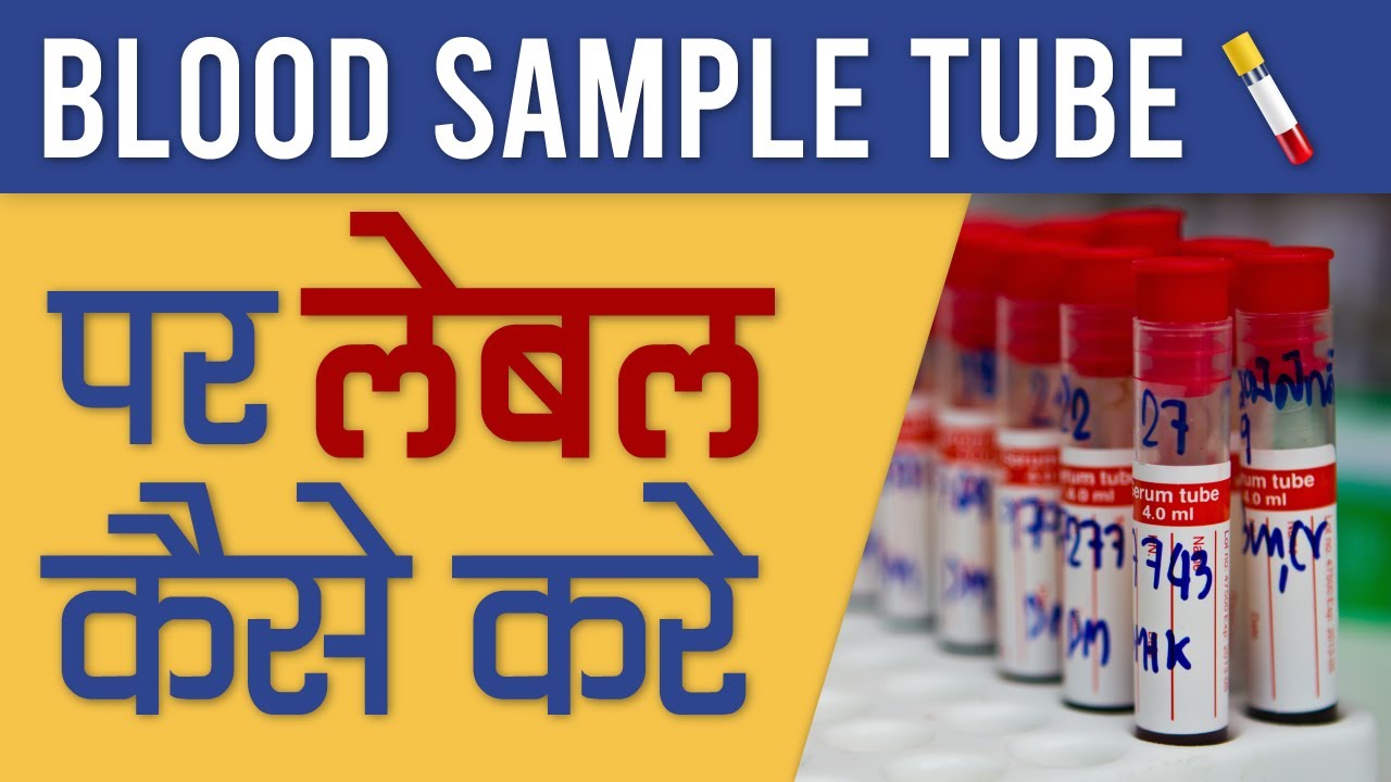 How to labels blood samples must include the following!! health - YouTube