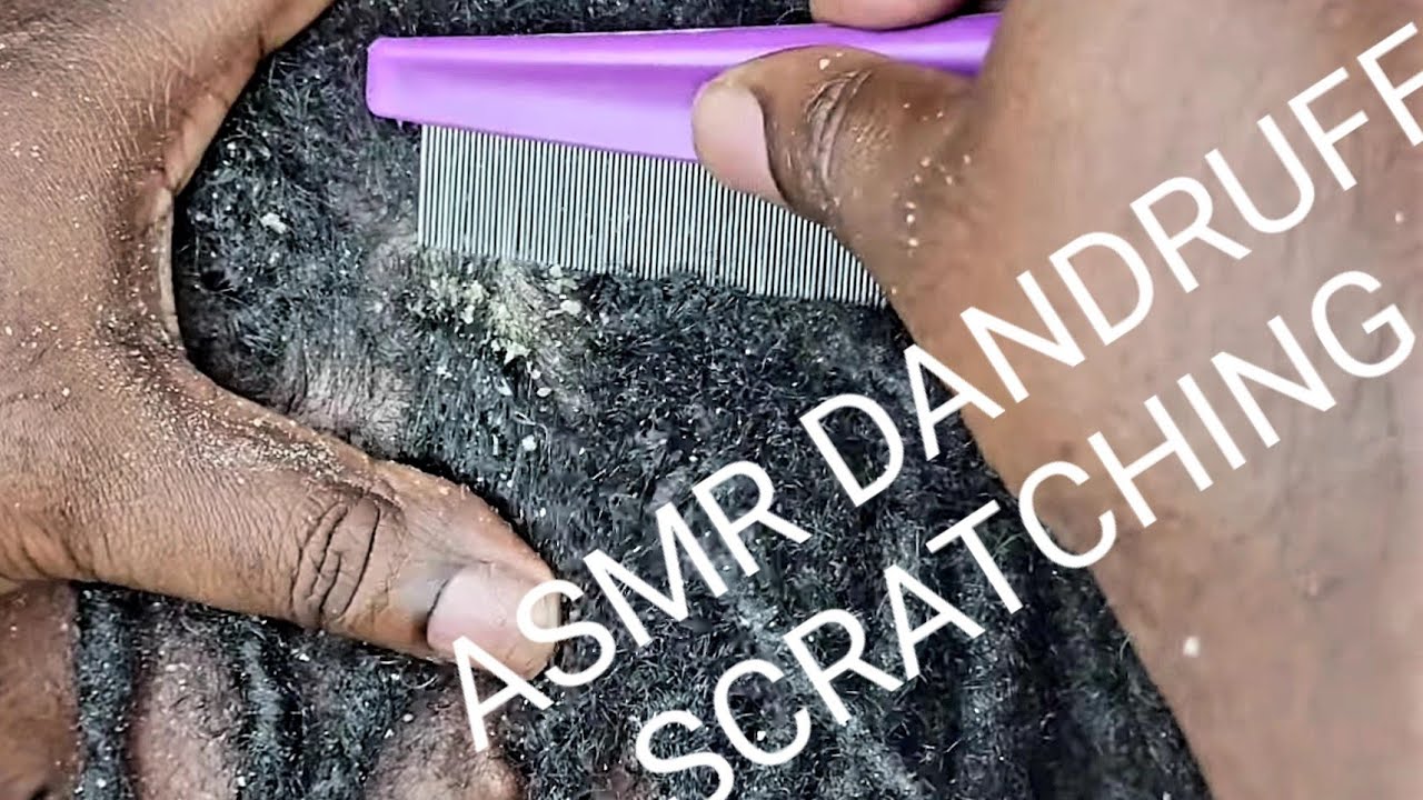 Quick Dandruff Scratch by Husband | 045 - YouTube