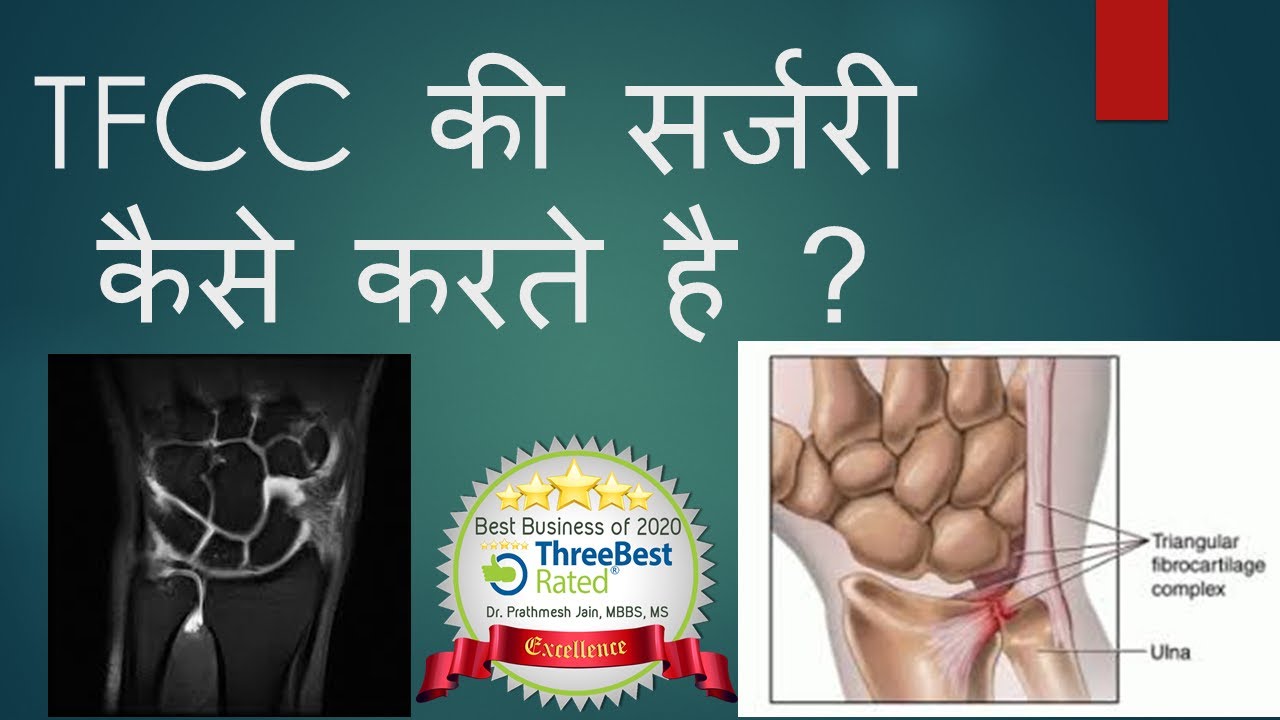 How we do TFCC repair in Hindi - YouTube