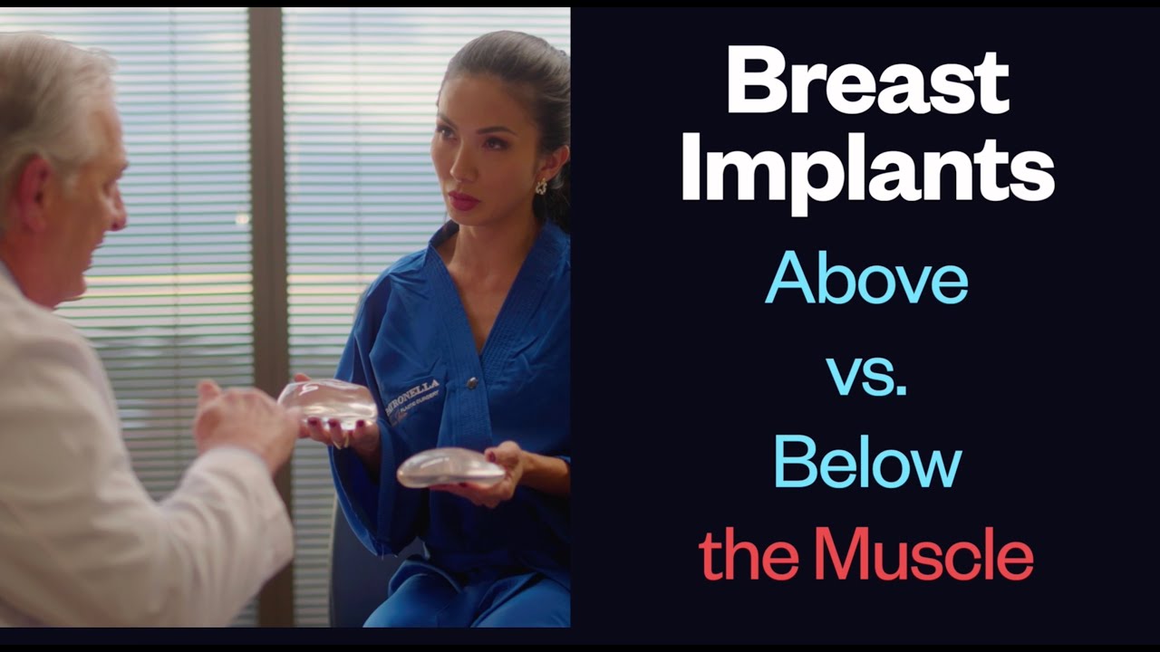 Breast Implants: Is Below or Above the Muscle Placement Better? - YouTube