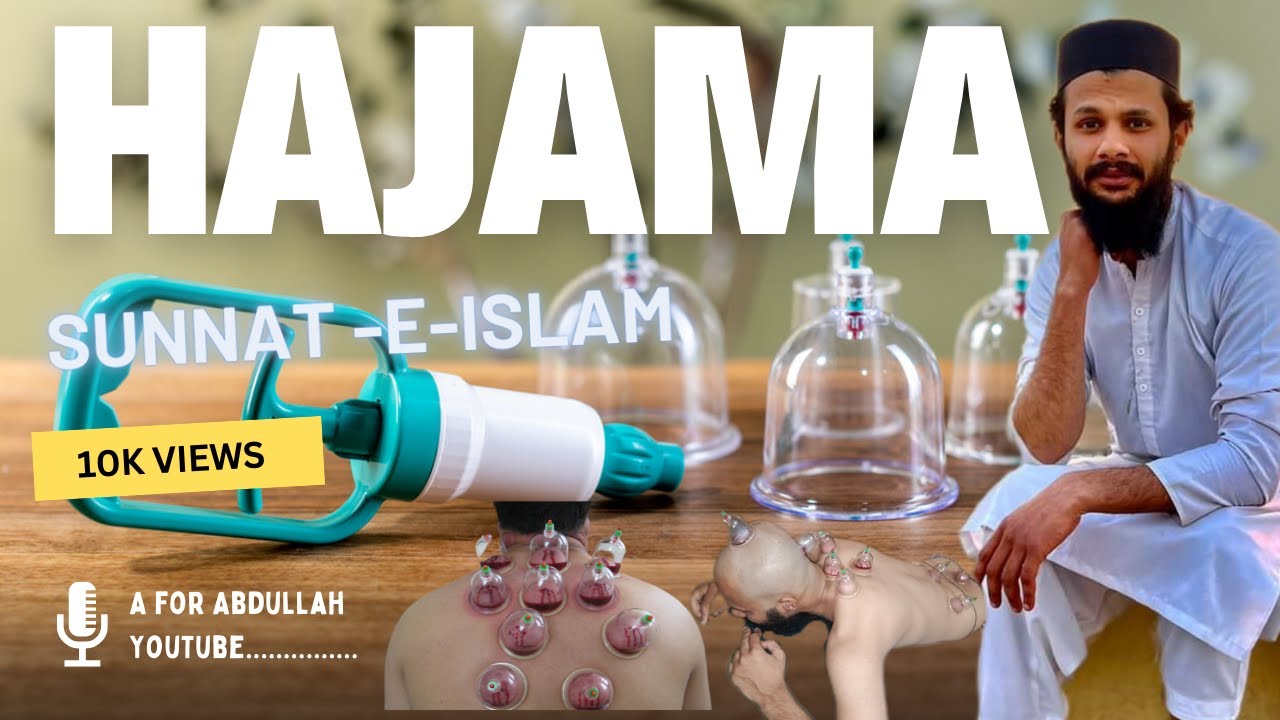 My First Hijama Cupping | Hijama for Skin Care | Cupping Therapy ...