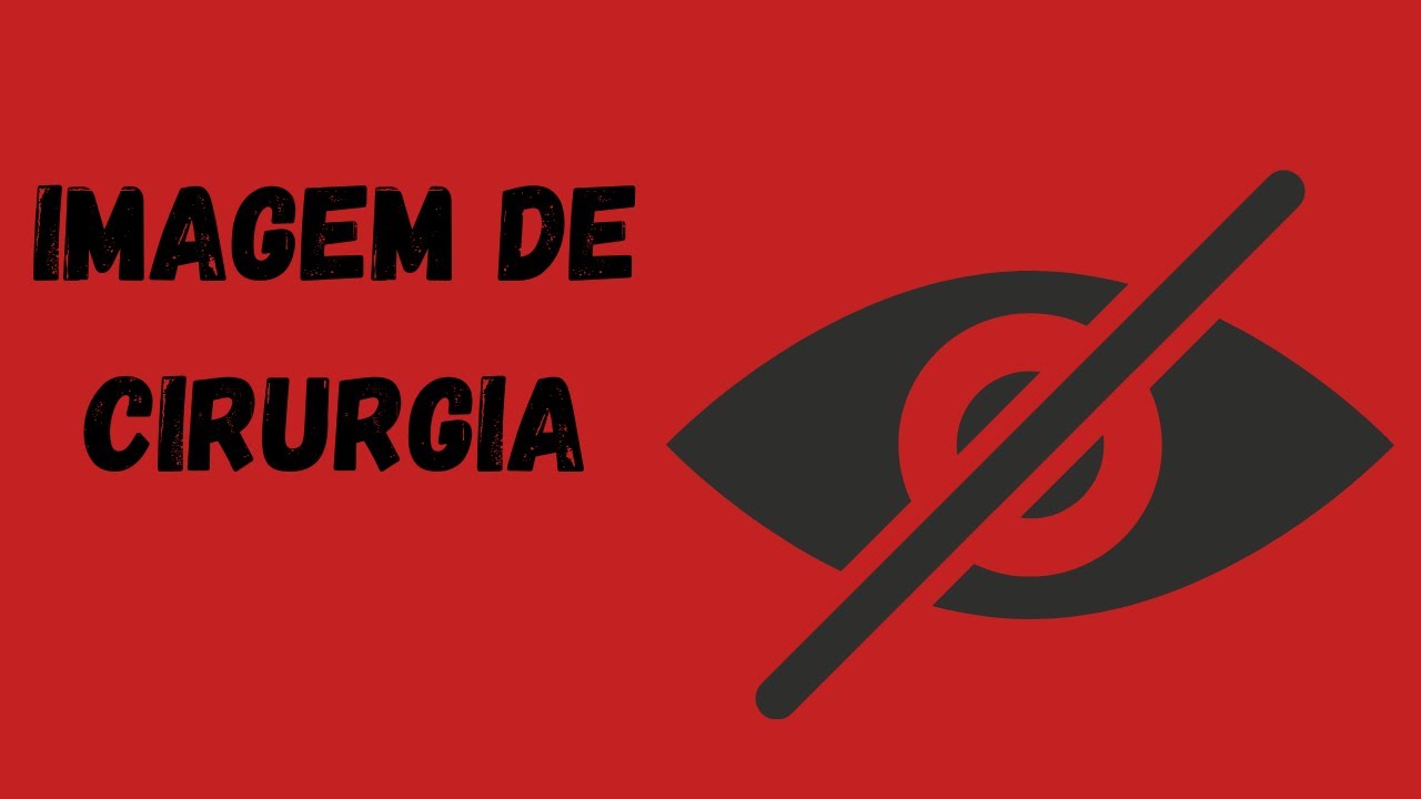 Cirurgia Da Sinusite Crônica - Sinusotomia Frontal. - YouTube