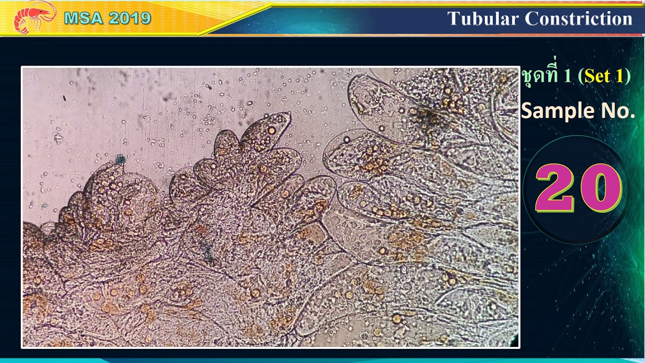 Constriction 01 20 - YouTube