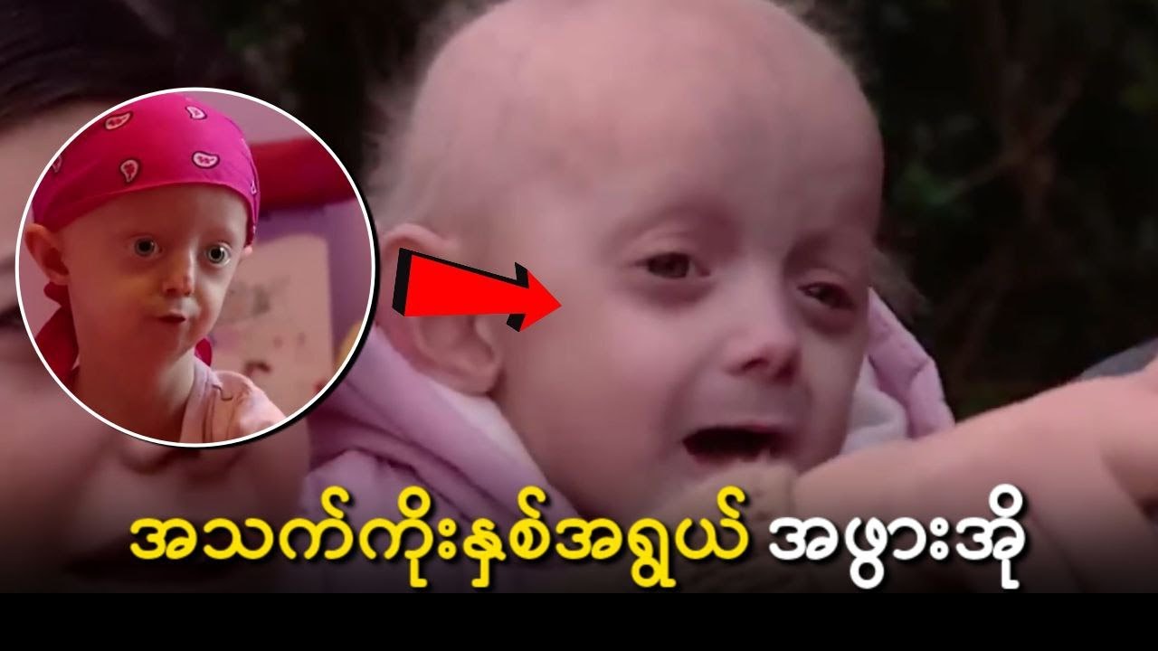 အသက် ၉ နှစ်အရွယ် အဘွားအို Youtube
