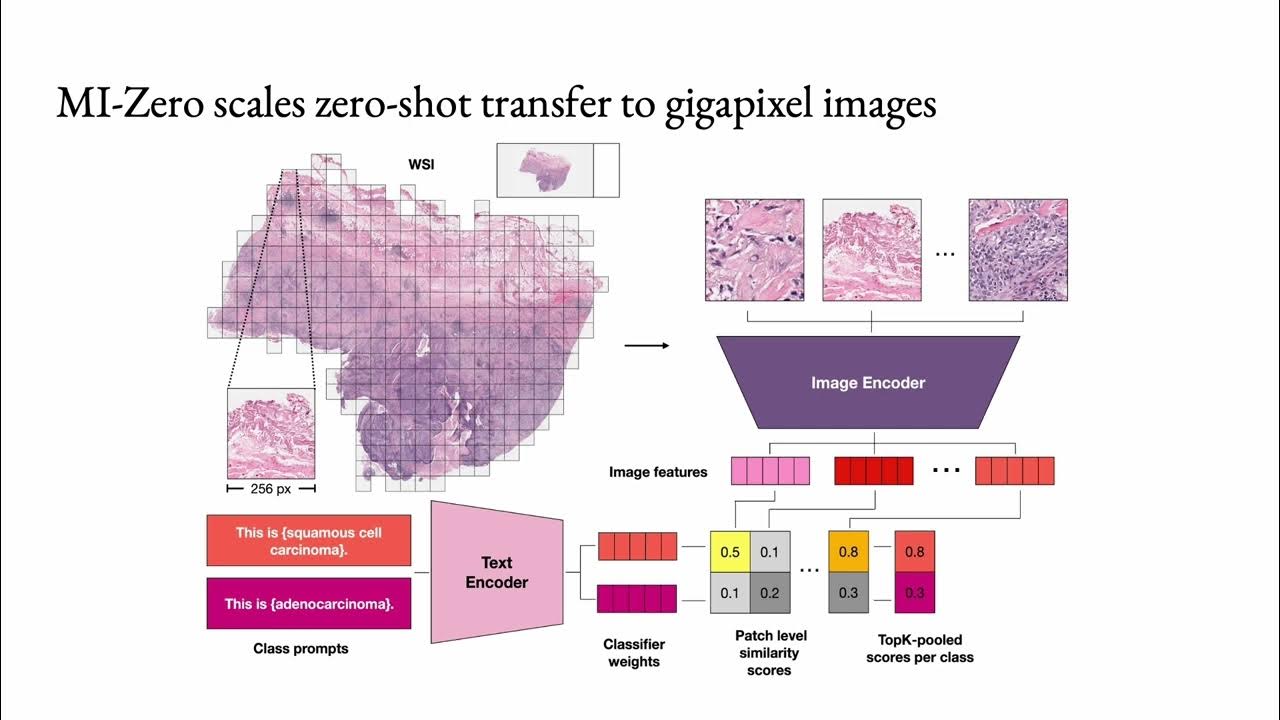 [CVPR2023] Visual Language Pretrained Multiple Instance Zero-Shot Transfer for Histopathology ...