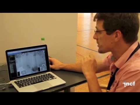Andrew Janke presents TissueStack - YouTube