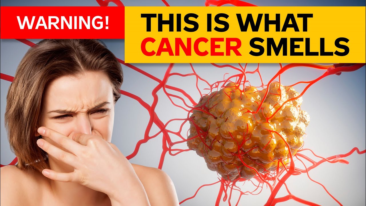 Smell from a person with CANCER. How does oncology smell? - YouTube