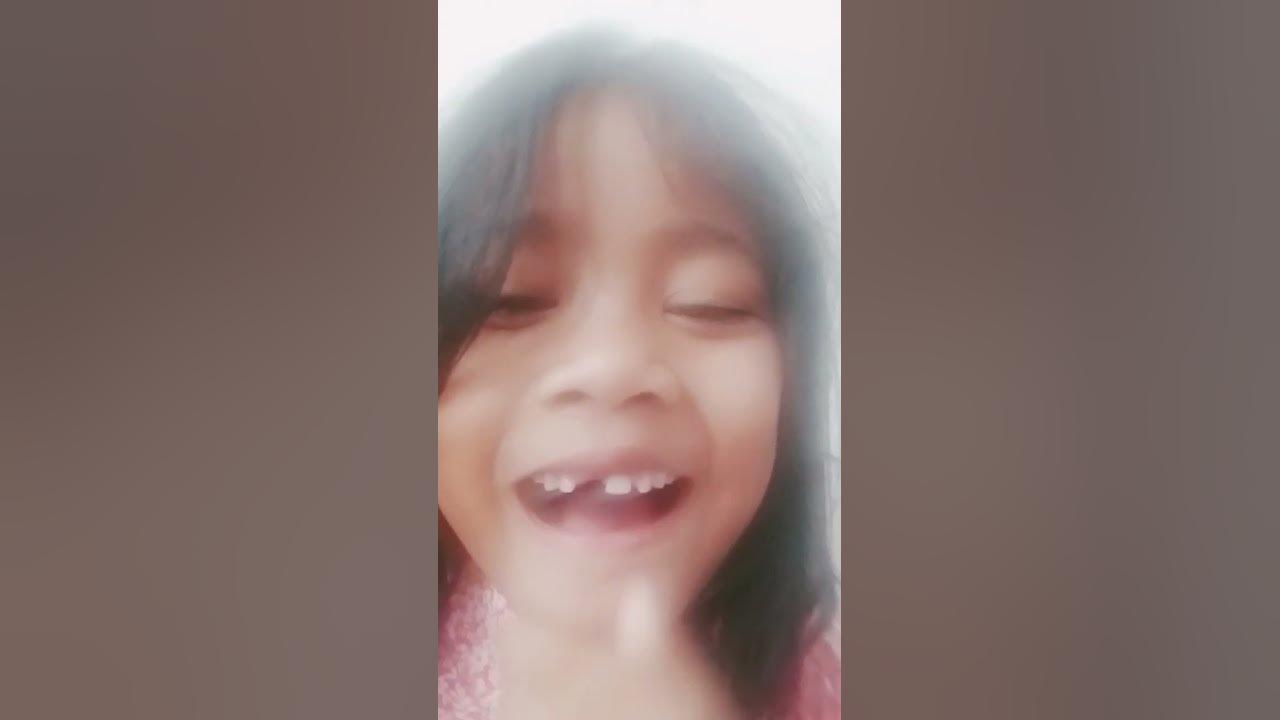 gigi copot tadi - YouTube