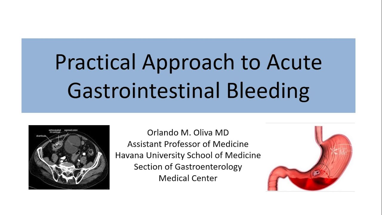 Acute Gastrointestinal Bleeding - YouTube