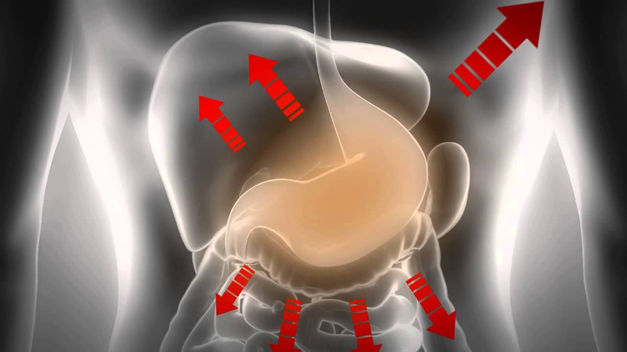 Fuel Your Fast - How to Avoid GI Distress During Exercise - Dr. Bob ...