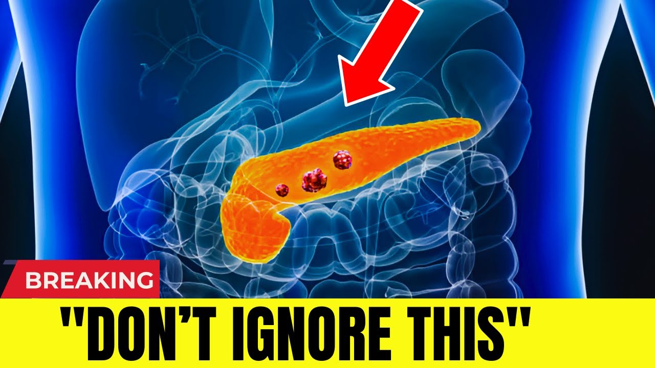 Pancreatic Cancer Symptoms You Should NEVER Ignore - YouTube