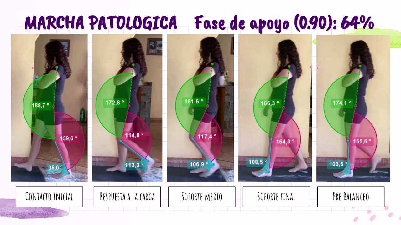 Análisis de marcha normal y patológica - Kinesiología USACH - YouTube