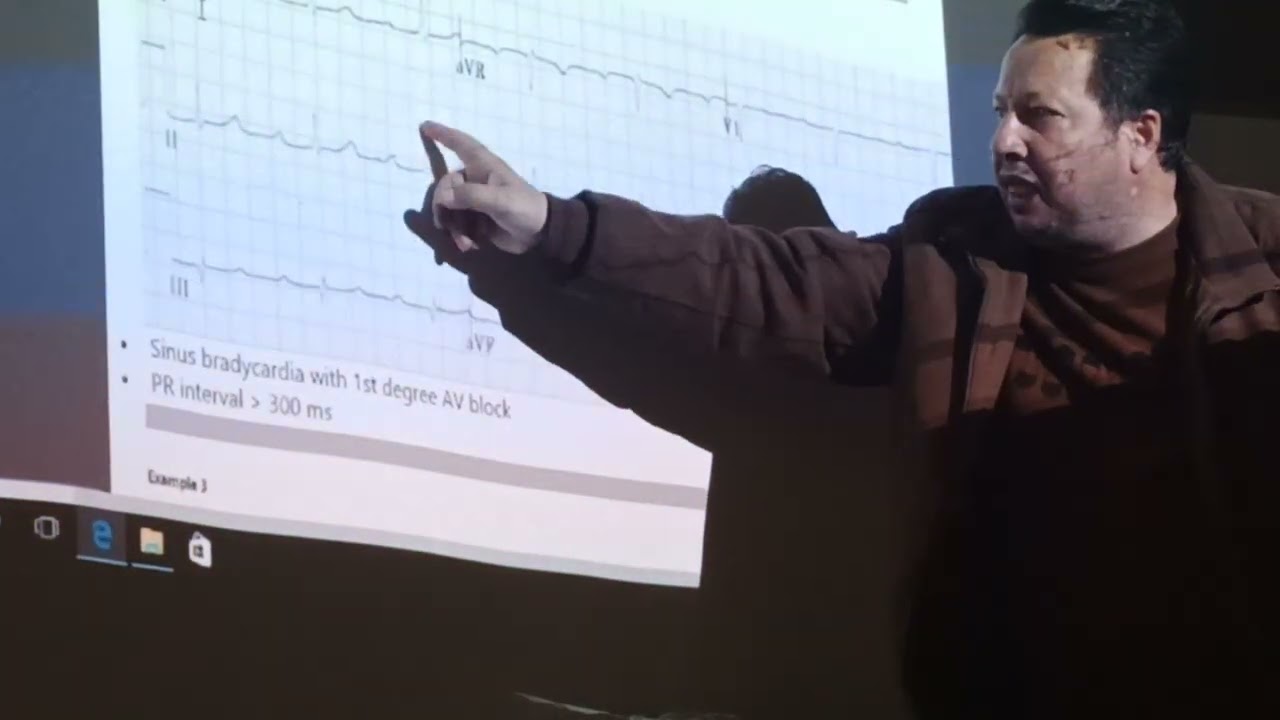ECG ,dr rahim: Heart block 1 - YouTube