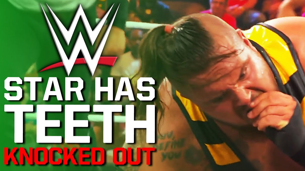 WWE Star Has TEETH KNOCKED OUT During Match | Botched Raw Spot Leads To ...