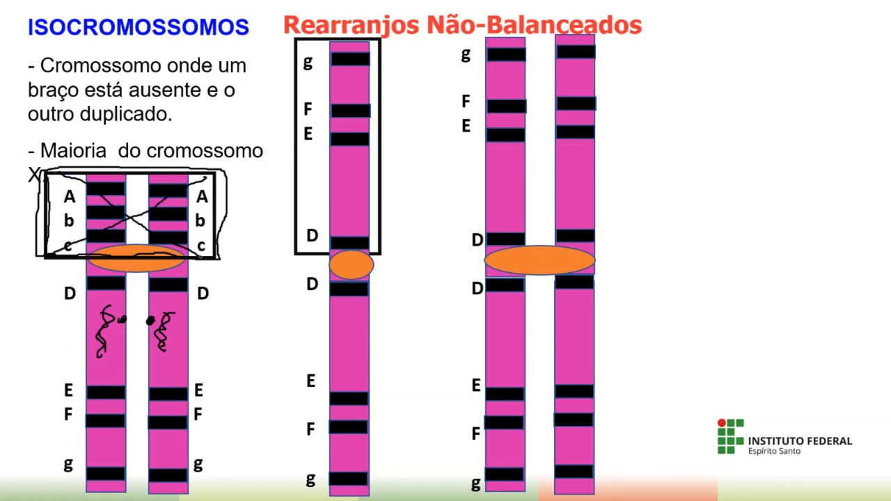 Citogenética - Alterações estruturais - translocação - trissomia ...