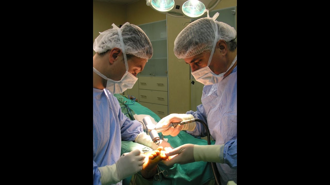 MONTURI, CONSULTATIE SI OPERATIE LA PROESTETICA - YouTube