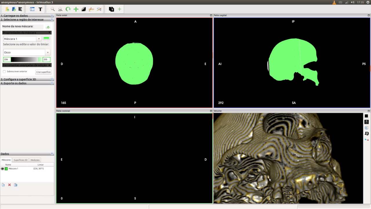 A fake CT-Scan of a 3D mesh scanned with PPT GUI - YouTube