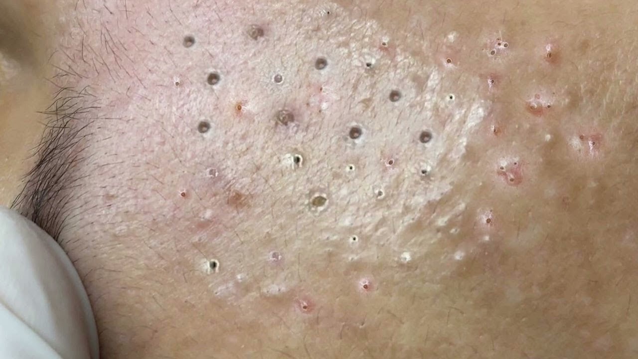 Sac Dep Spa 2022 Youtube