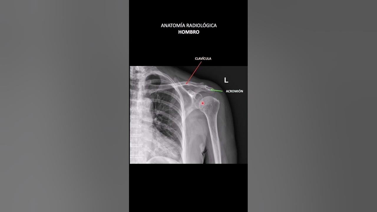 🦴📹 Anatomía radiológica de hombro. #radiologist #radiology #radiologia - YouTube
