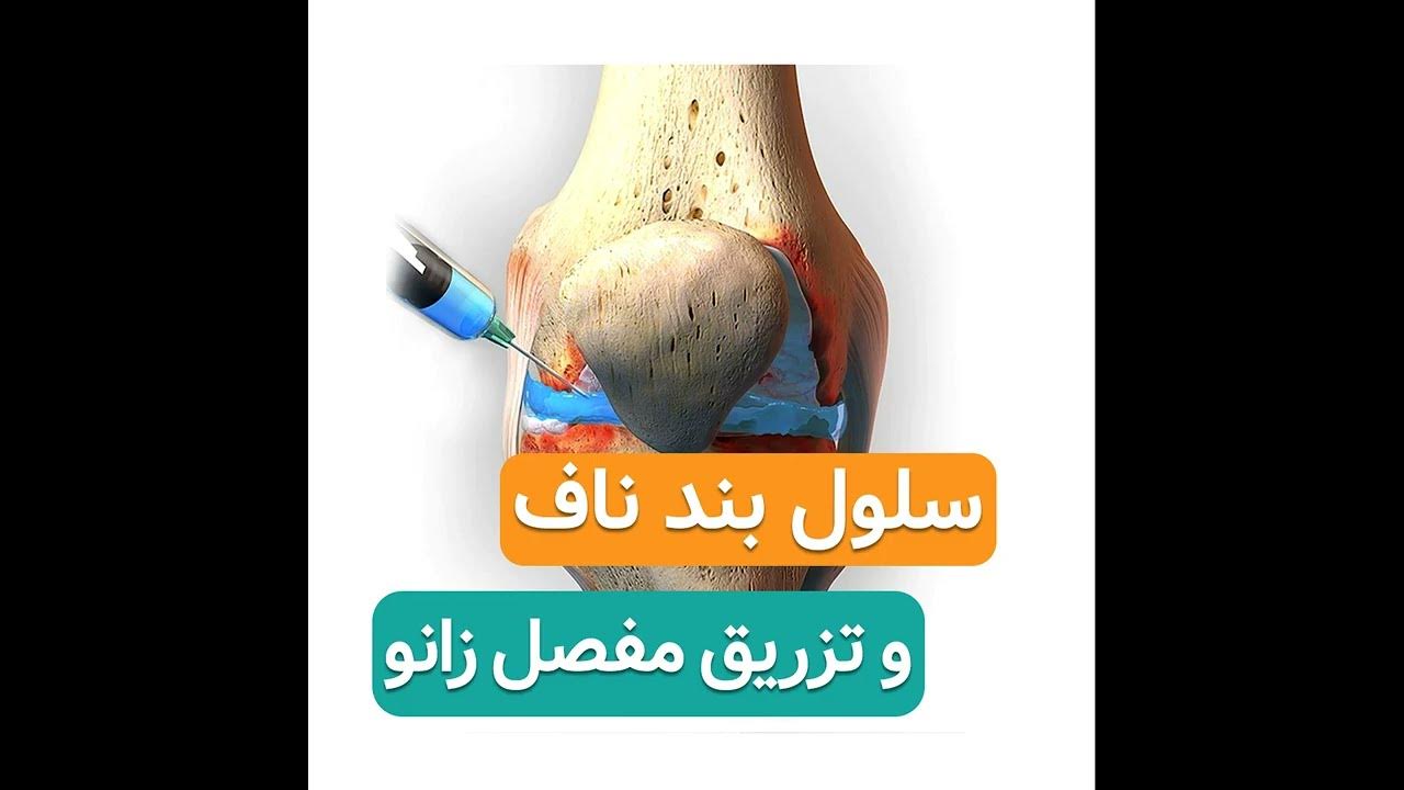 سلول بنیادی بند ناف جفت و تزریق مفصل زانو دکتر محمدرضا صادقی