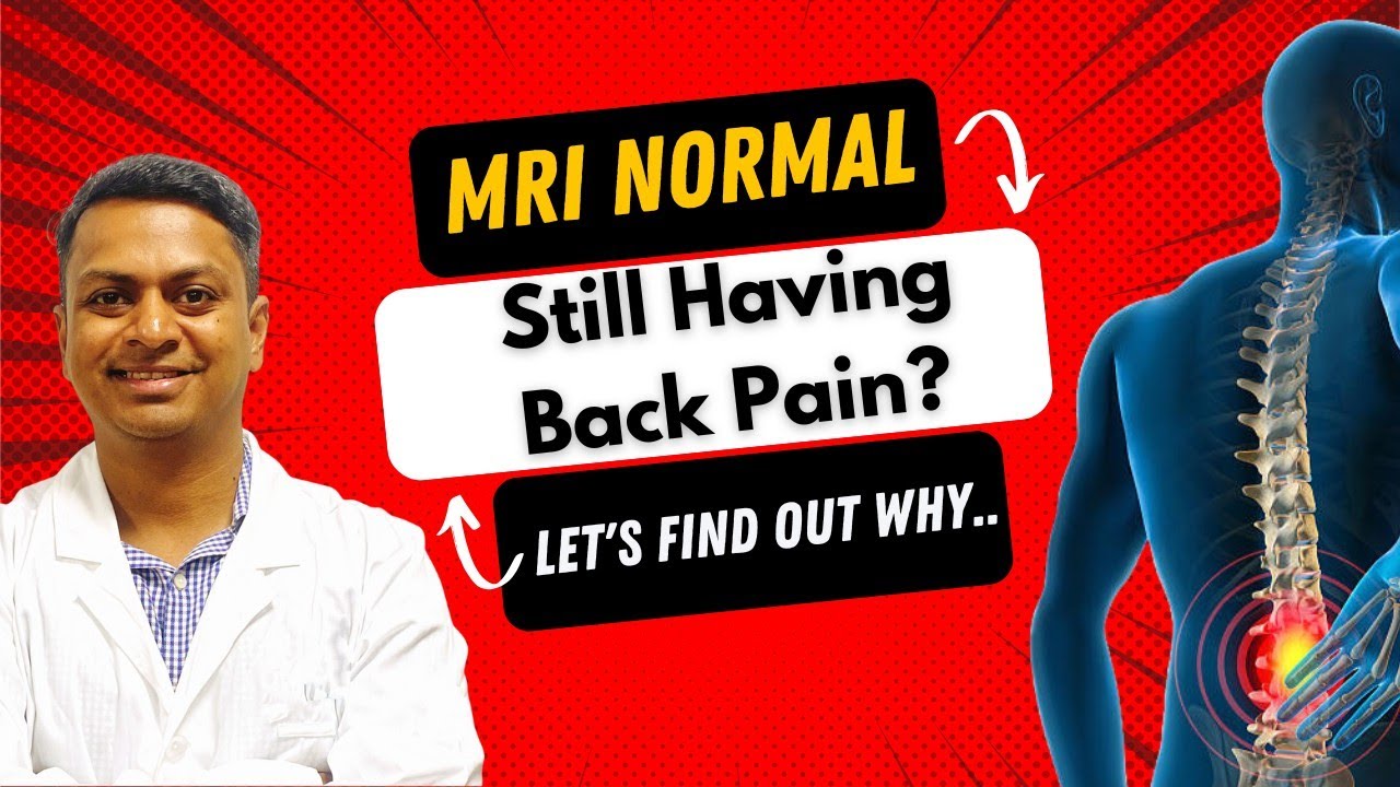 BACK PAIN SERIES video 3 : MRI NORMAL, Still Having Back Pain? Let's ...