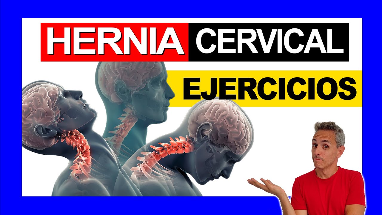 Hernia Discal CERVICAL C5 C6 Tratamiento + 7 EJERCICIOS - YouTube