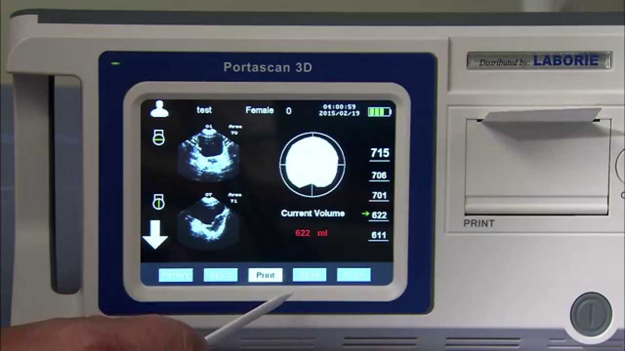 Portascan™ 3D - YouTube