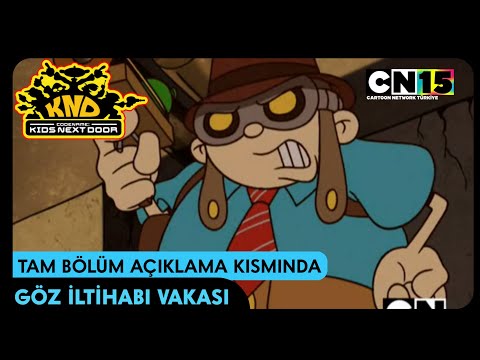 Kod Adı Afacanlar | Göz İltihabı Vakası | Kısa Sahneler