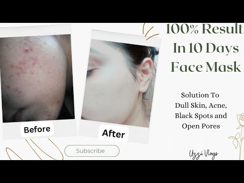 3 INGREDIENT DESI TOTKAY NE KHADEEJA KI SKIN THEEK KARDI| All skin type ...