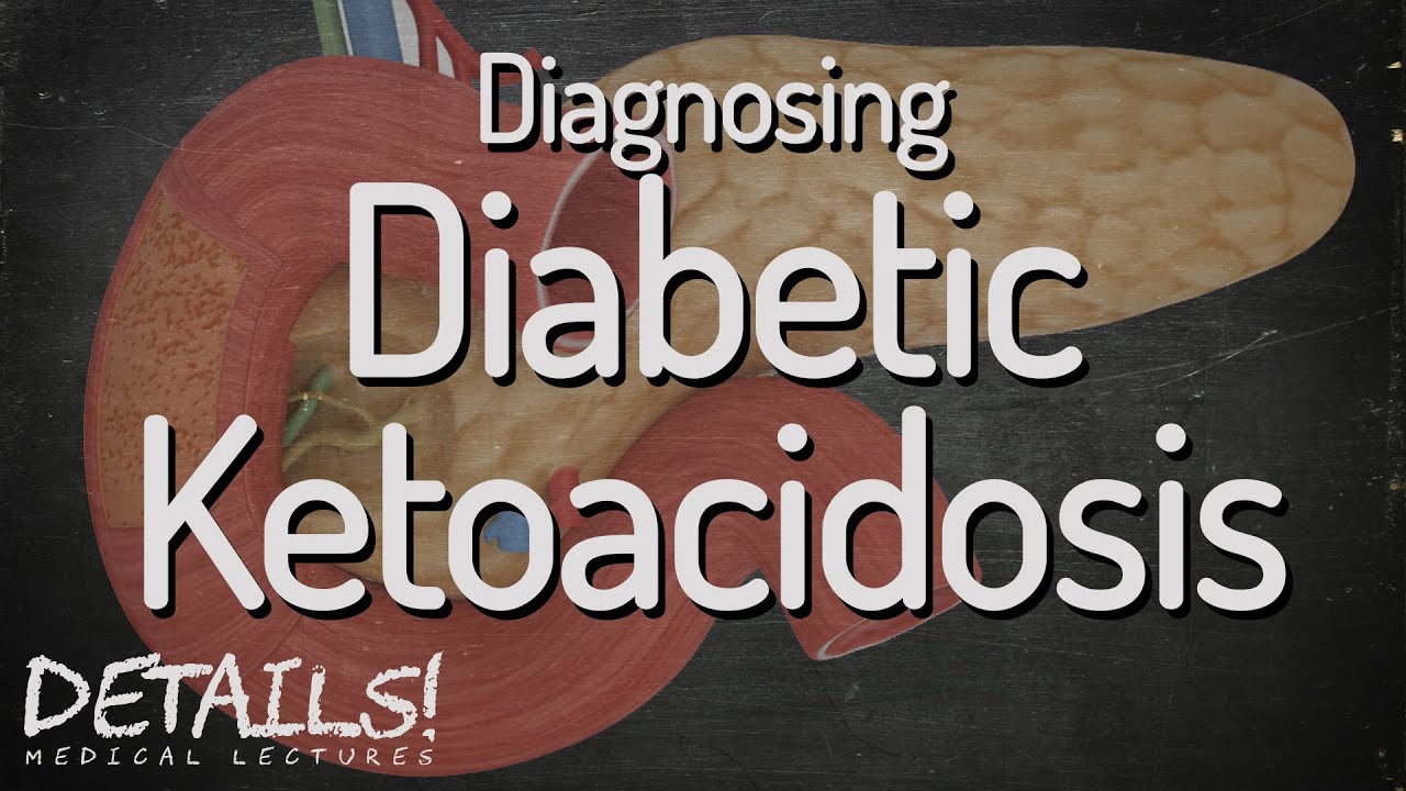 Diagnosing Diabetic Ketoacidosis | Details - Diabetes
