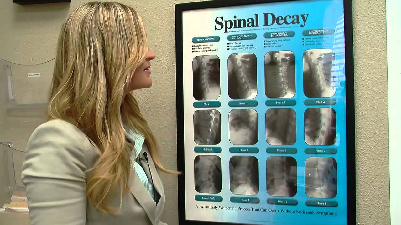 Spinal Decay Chart - YouTube