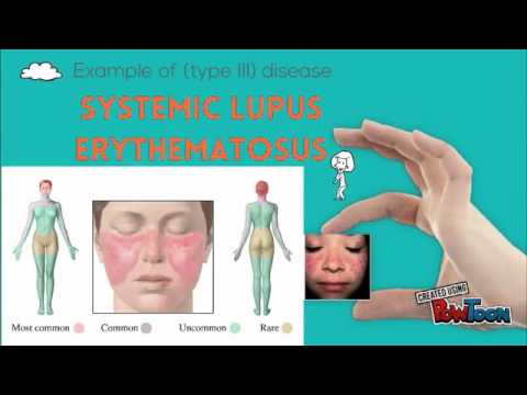 Hyperemia...1 - YouTube