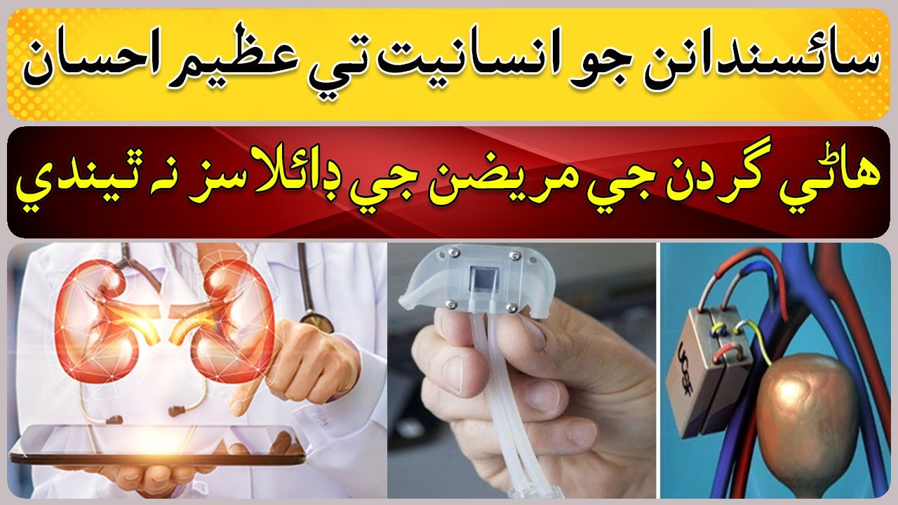 Scientists solve the problem of kidney patients, Bionic kidney invented ...
