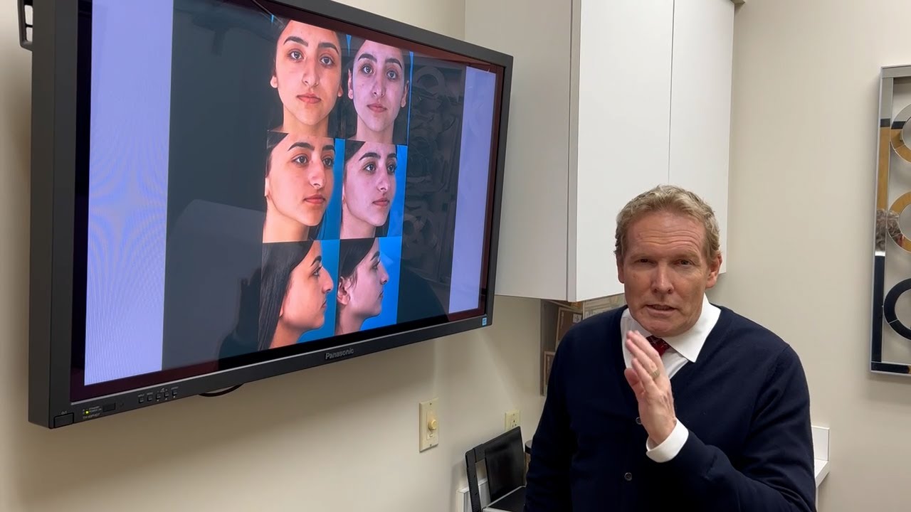 Dr. Swanson describes the Rhinoplasty (nose job) procedure. - YouTube