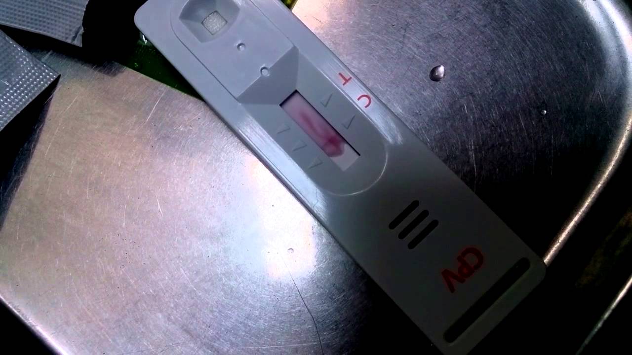 Test parvo - YouTube