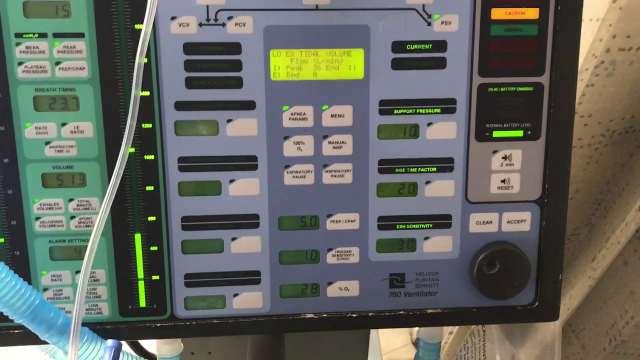 Puritan Bennett 760 ventilator review - YouTube