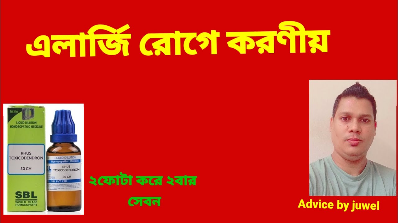 এলার্জি হলে কি করনীয় l চুলকানির ঔষধ l এলার্জি হলে কি করনীয় l chulkani ...