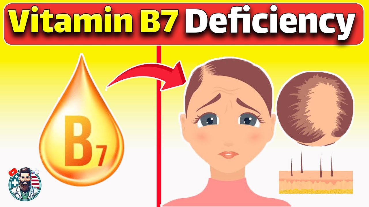 Vitamin B7 Biotin Deficiency | Sources, Symptoms,Treatment - YouTube