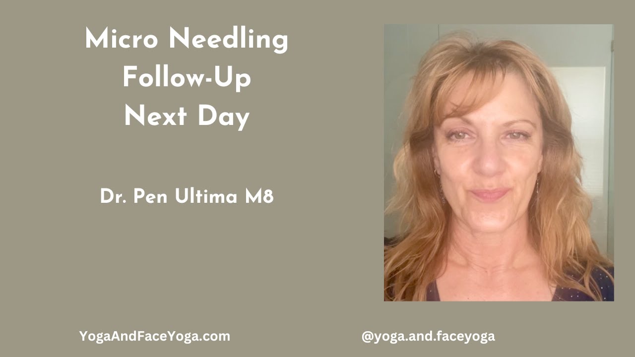 Micro Needling Follow-Up, Next Day - YouTube