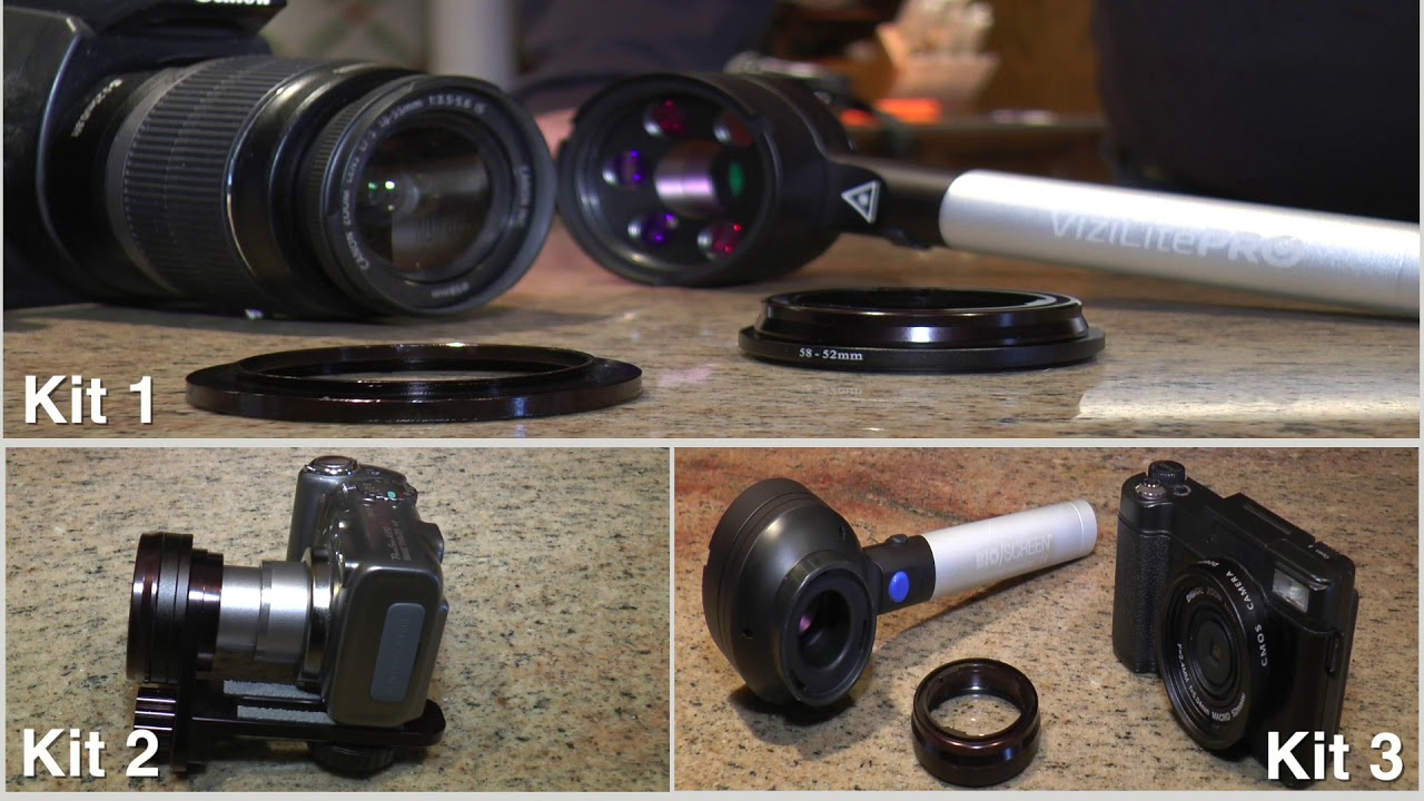 ViziLite PRO Dental Cam System - YouTube