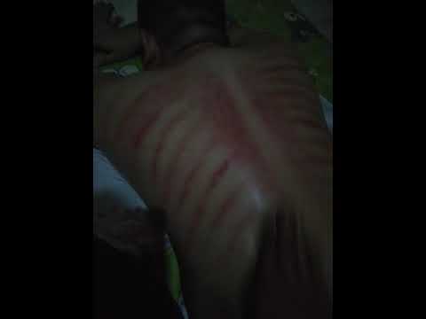 pijat kerikan masuk angin merah semua