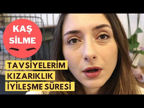 KAŞ SİLME İŞLEMİ 5 AYLIK SONUÇ  (Solüsyonla Kaş Silme, Kızarıklıklar geçti mi? İşe yaradı  mı?)
