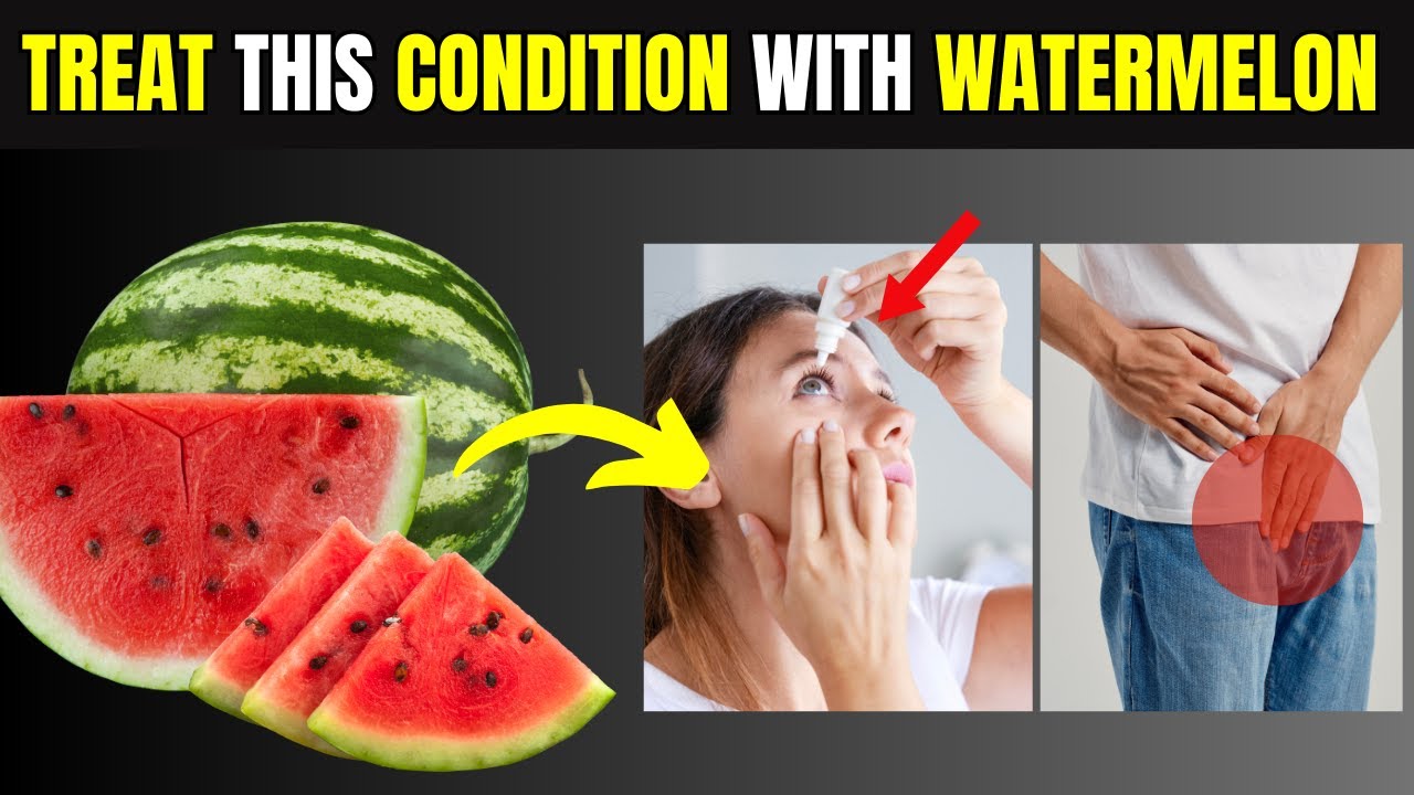Top 7 Conditions You Can Treat With Watermelon - YouTube