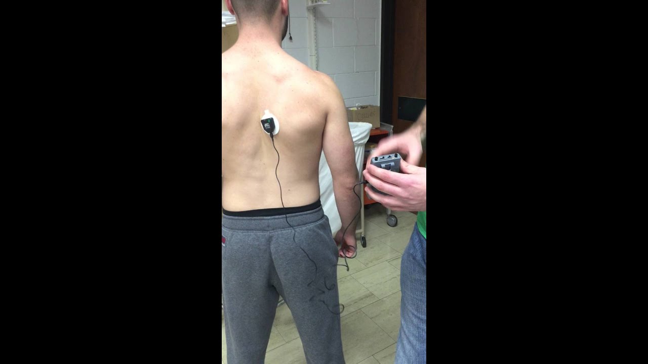 Case 23 - Myotrac Biofeedback - YouTube