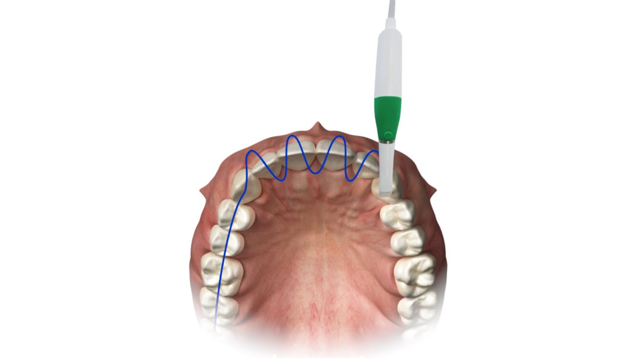 Full arch scan pattern for Planmeca Emerald™ scanners - YouTube