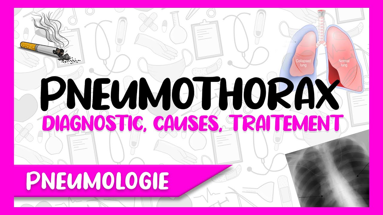 Le PNEUMOTHORAX Expliqué Très Clairement : Définition, causes ...