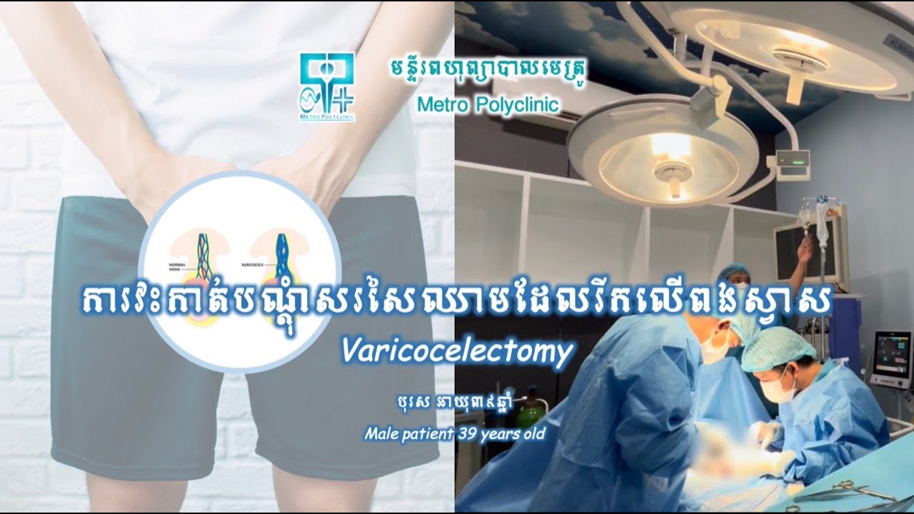 ការវះកាត់បណ្ដុំសរសៃឈាមដែលរីកលើពងស្វាស លើបុរស អាយុ៣៩ឆ្នាំ ...