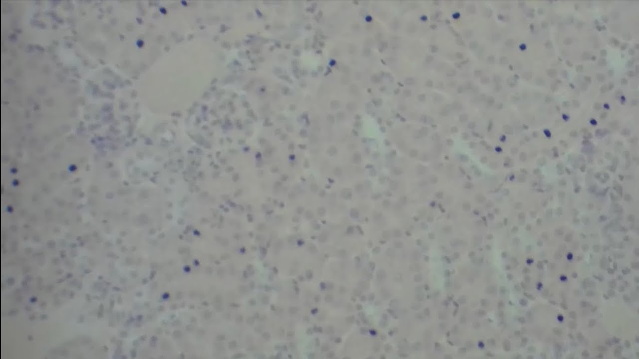 Kidney (Specimen 37) under a microscope. - YouTube