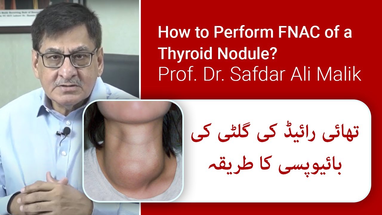 How to Perform FNAC of a Thyroid Nodule | Prof. Dr. Safdar Ali Malik ...
